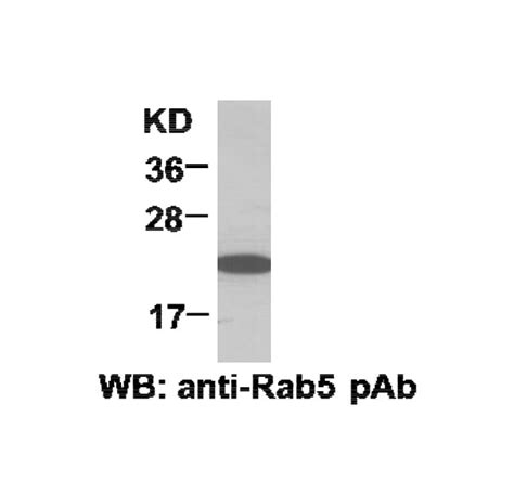 Rab5 Pab Neweast Biosciences Gtpase Oncogene And Bioactive Protein