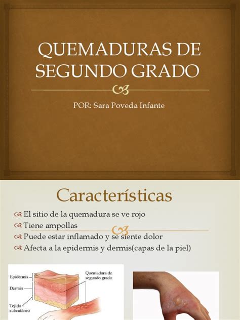 Quemaduras De Segundo Grado Pdf