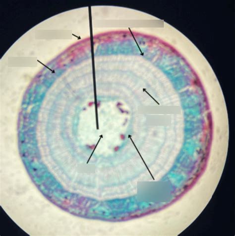Botalab 3 Year Old Tilia Stem [diagram] Diagram Quizlet