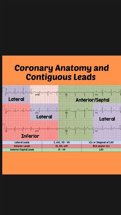 Coronary Artery And Contiguous Leads Artofit
