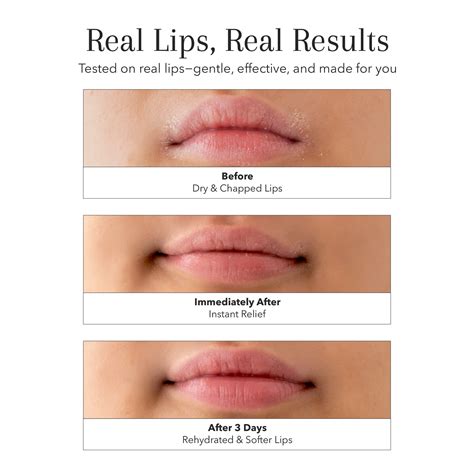 Lip Rescue Balm Joi Singapore