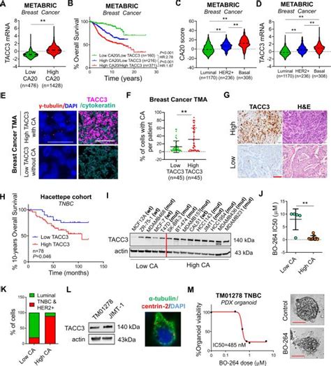 Erden Banoglu On Linkedin Targeting Tacc3 Represents A Novel Vulnerability In Highly Aggressive…