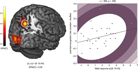 Correlation Of Precuneus Activation And Delayed Memory Performance