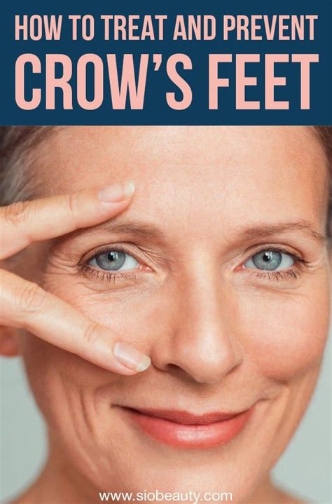 How To Prevent And Get Rid Of Crows Feet Around Your Eyes Saggy Skin