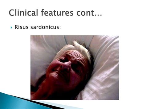 Tetanus Prophylaxis And Types Of Immunitynewnewv Pptx Infectious