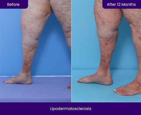 Gallery Cosmetic And Veins Clinic Tauranga