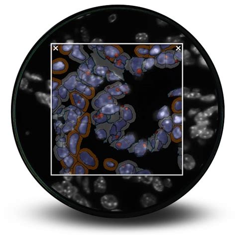 Acd Webinar An Overview Of Quantitative Image Analysis Of Rnascope
