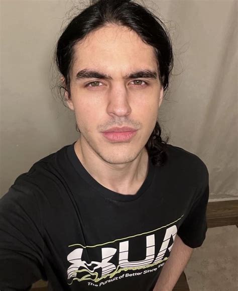 Recessed Maxilla Rorthotropics