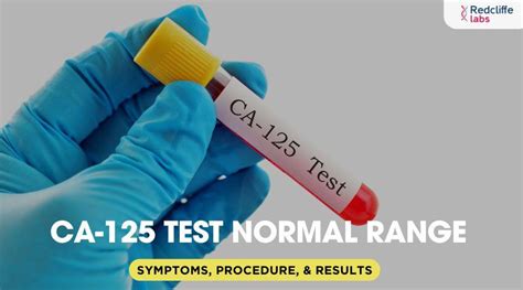 Ca 125 Test Normal Range Symptoms Procedure And Results