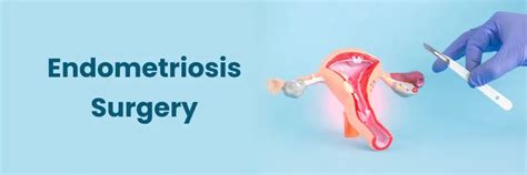 Endometriosis Surgery Types Benefits And Recovery Process