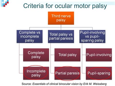 Case Presentation Third Nerve Palsy Ppt