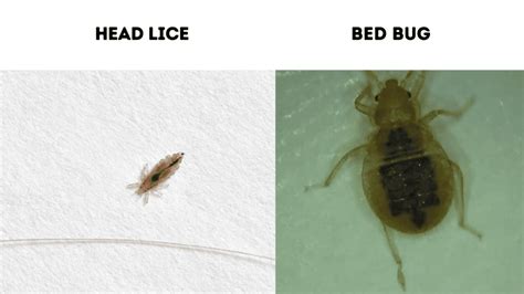 Bugs That Look Like Lice Head Lice Information Mount Sinai New