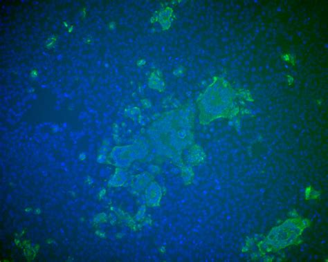 Rsウイルスによる細胞変性効果 微生物部 山形県衛生研究所
