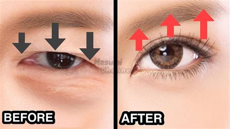 How To Get Bigger Eyes Without Makeup Or Surgery Saubhaya Makeup