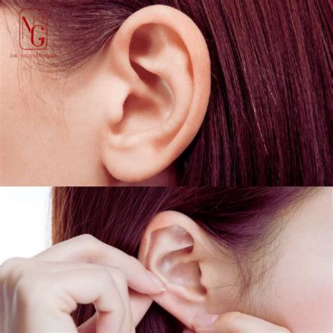 Why Do My Ears Stick Out So Much Physiognomy Meaning Dr Nguyen Giap