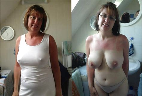 Mature Dressed And Undressed 16 Pics Xhamster