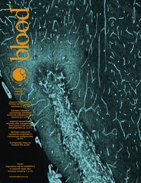 Retracted Adamts13 Controls Vascular Remodeling By Modifying Vwf