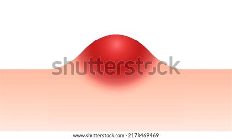 Pubertate Over 115 Royalty Free Licensable Stock Illustrations