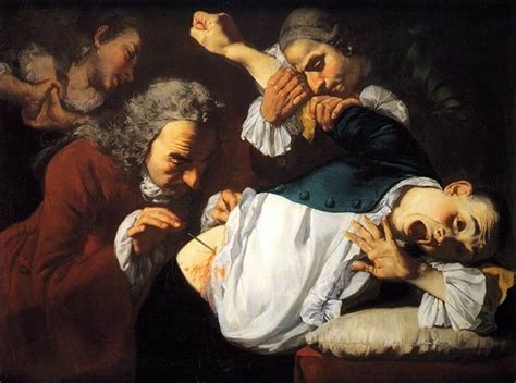 The Operation The Wound