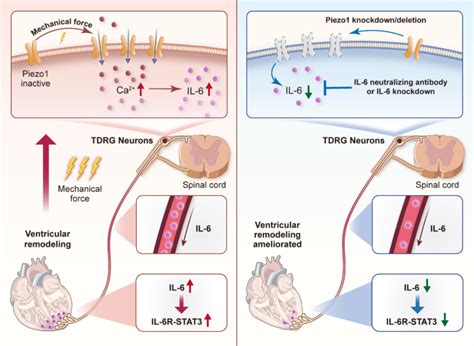 二附院麻醉与围术期医学科团队发现心梗后心室重构新机制