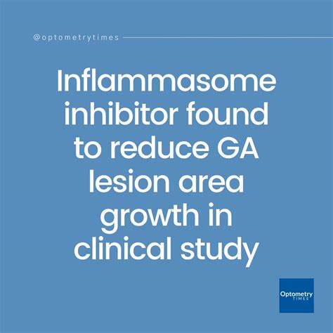 Optometry Times Poll Which Of These Do You Require Of Patients In
