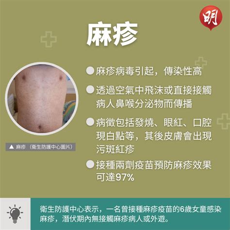 明報即時新聞 麻疹｜6歲女染麻疹潛伏期無外遊無接觸患者 一文了解麻疹及預防方法【附麻疹疫苗資訊圖】 Facebook