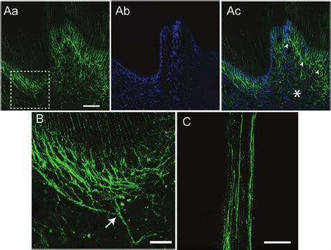 Dense Projection Of Gfp Positive Afferent Terminals In A Download