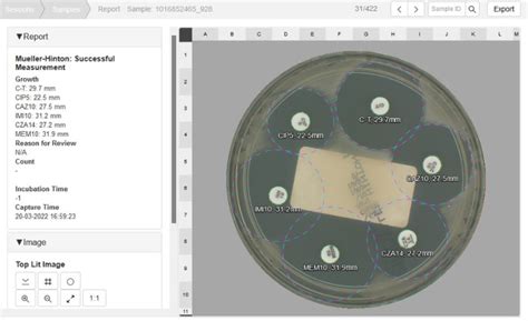 Automated Disc Diffusion Plate Reading Detection Of Amr