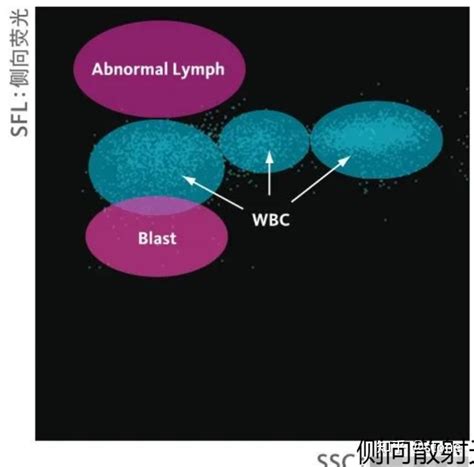 Sysmex Xn系列血细胞分析仪 白细胞散点图 知乎