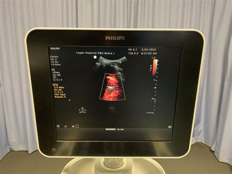 Philips C6 2 Broadband Curved Array Probe Ultrasound Transducer For Sparq Auschoice