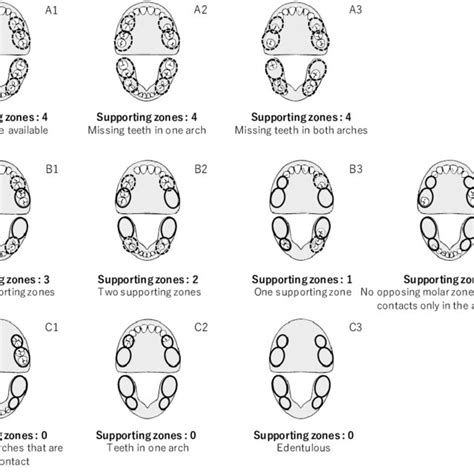 Definition Of Occlusal Support Conditions By The Miyachi Classification Download Scientific