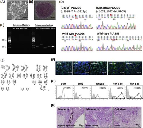 Generation Of Ipscs From A Young Onset Parkinsons Disease Patient Carrying Pla2g6 Mutation