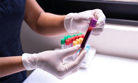 Hemoglobin U Krvi Šta Je Nizak Povišen Normalne Vrednosti Permadent