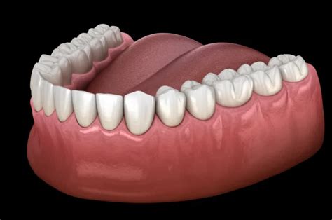 Best Hospital For Mandibular Fixation Surgery In India Medisuggest