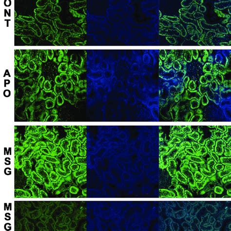 Galectin 3 Gal 3 Immunofluorescence Staining In The Experimental