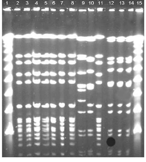 Pfge Of Smai Digested Genomic Dna Of S Aureus Clinical Isolates Lanes