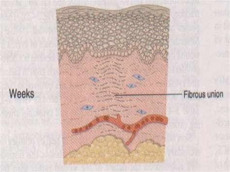 Tissue Renewal And Repair Bodys Ability To Replace Injuredppt