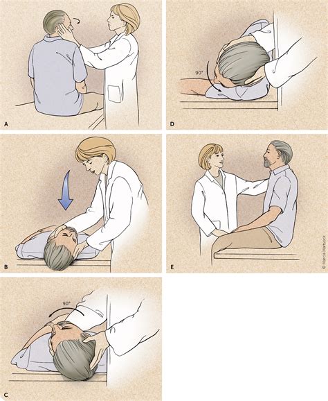 Dizziness Evaluation And Management Aafp