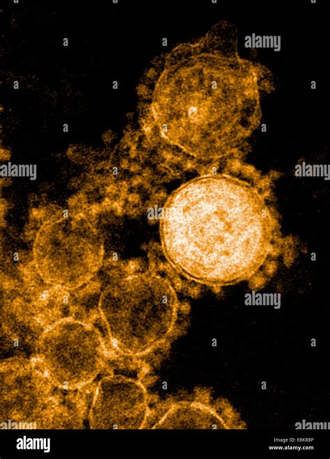 Colorized Transmission Electron Micrograph Showing Particles Of Middle