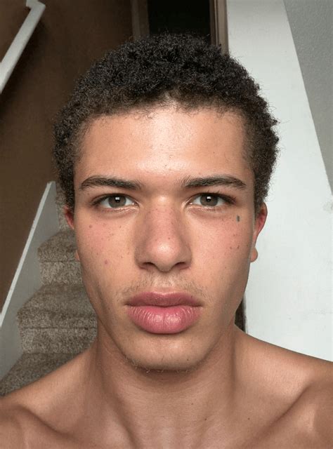 Surgery Advice How Can I Be Chad Mens Self
