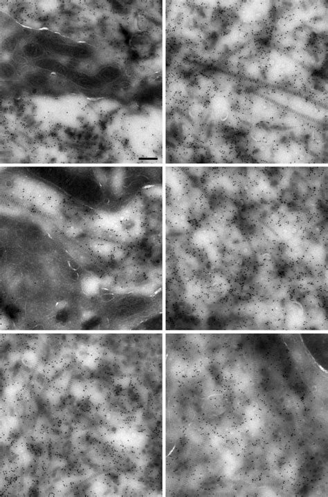 Immunoelectron Microscopy ‒ Bioem ‐ Epfl