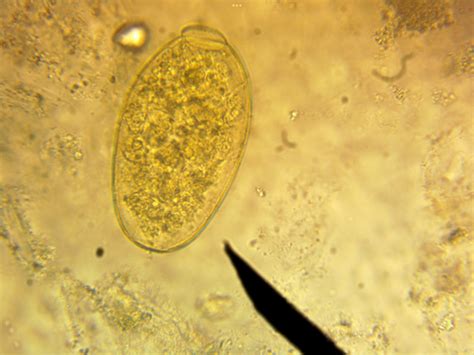 8candd Trematodes Intestinal And Lung Flukes Flashcards Quizlet