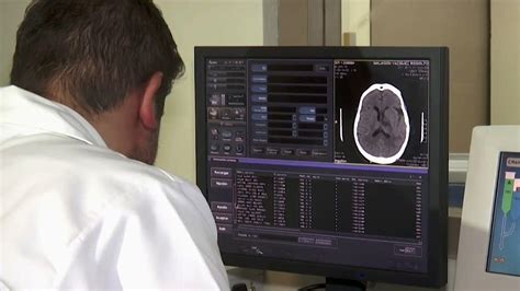 ¿qué Hacer En Caso De Un Infarto Cerebral N