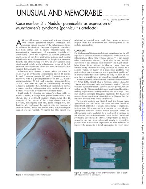 Pdf Nodular Panniculitis As Expression Of Munchhausen Syndrome