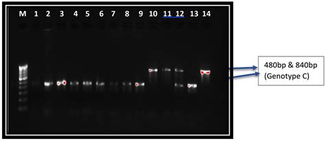 Genotyping Of Candida Albicans And Comparison Of Its Antifungal