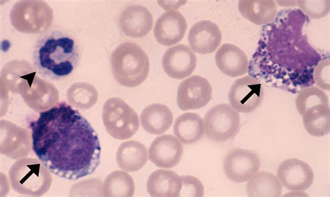 Mast Cells Cells And Smears