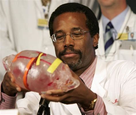 Ben Carson My Hero