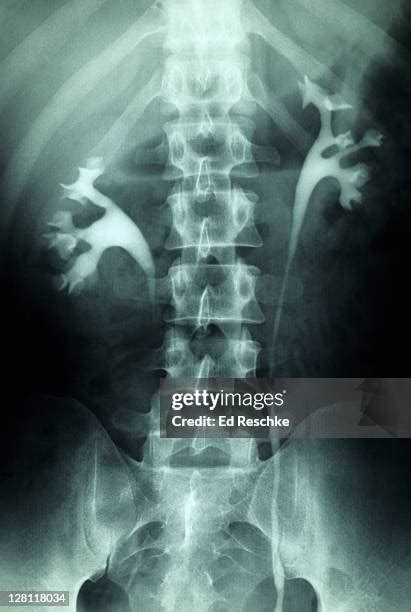 Ivp Photos And Premium High Res Pictures Getty Images