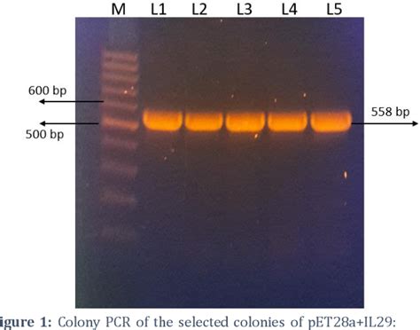 Figure 1 From Enhancing The Expression And Purification Of Il 29 A