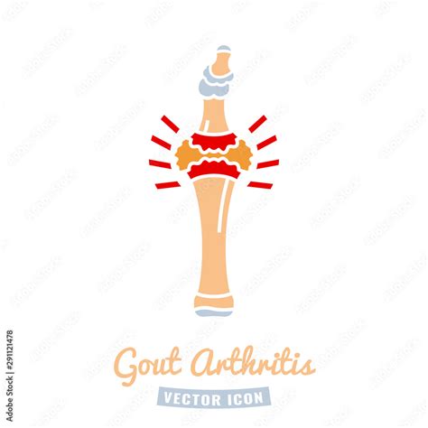 Gout Arthritis Icon Stock Vector Adobe Stock